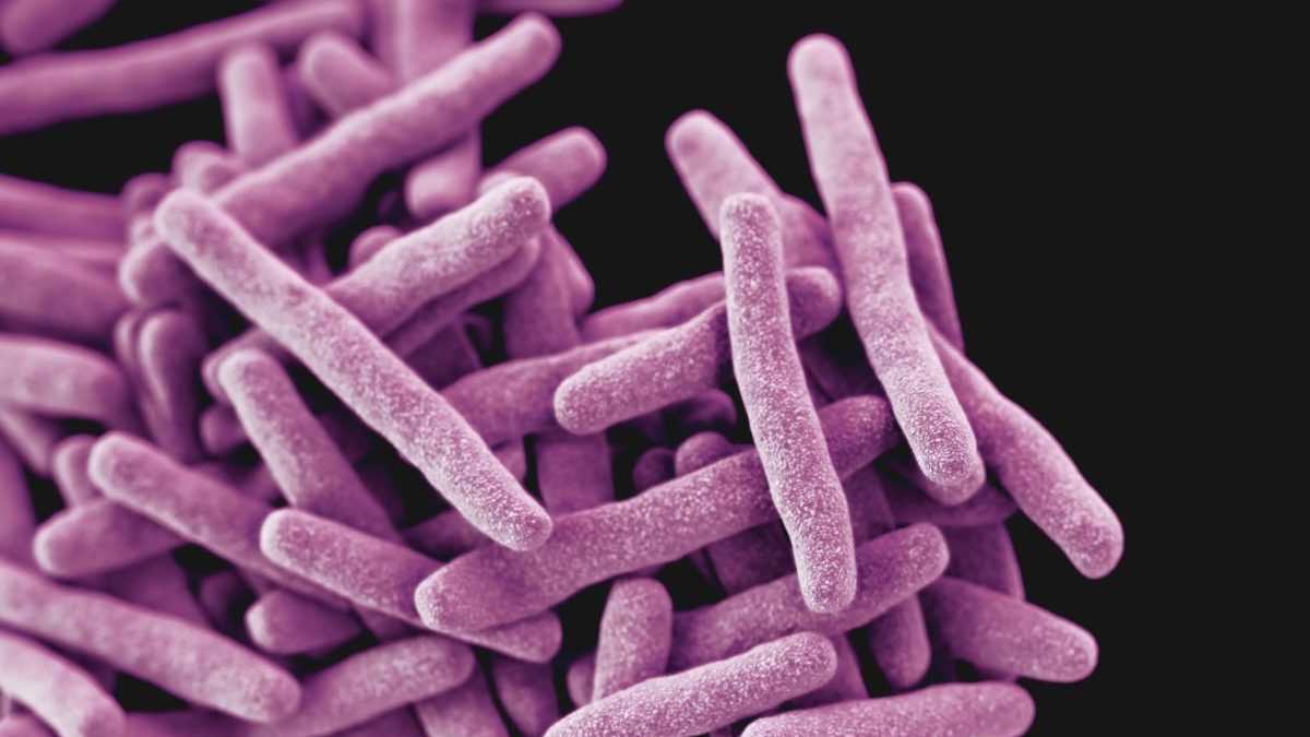 Tuberkulóza sa opäť šíri s novou silou, varuje WHO - Správy STVR