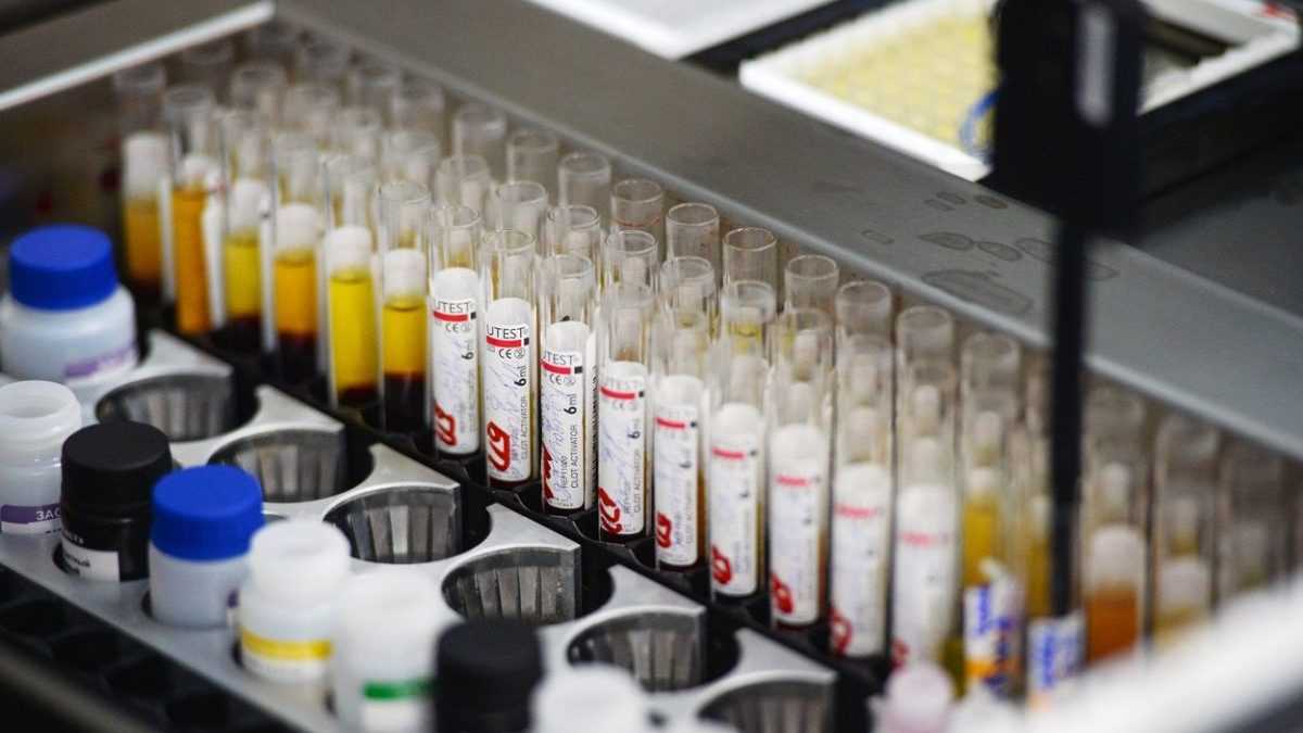 Sexuálne prenosné ochorenia sú u nás na vzostupe - Správy STVR