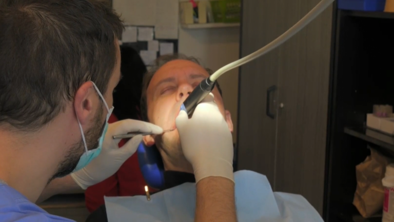 Rušia sa zubné benefity, zubári hlásia nápor na ambulancie - Správy STVR