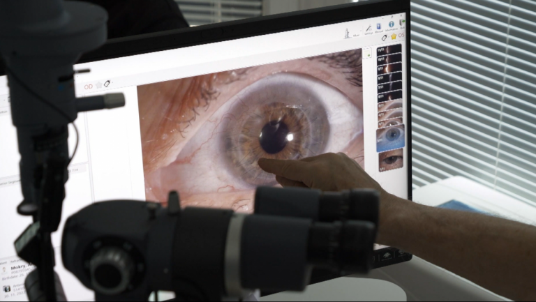 Od prvej implantácie rohovky uplynulo 45 rokov - Správy STVR